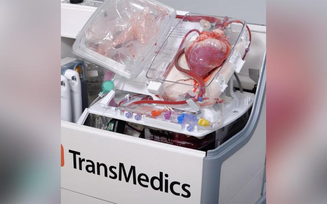 Ground-breaking Technology Allows ‘Dead’ Hearts to Be Transplanted ...